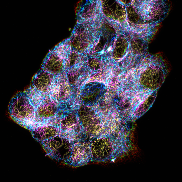 Cytoskeleton at Insulin Secreting Adhesions | Kaverina Lab | Vanderbilt ...