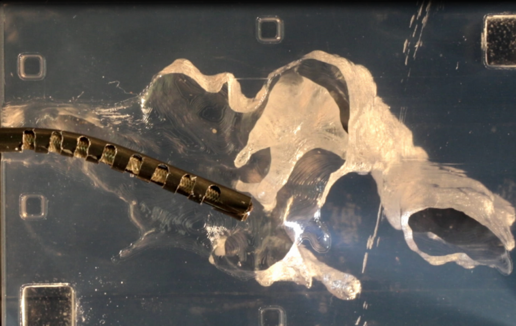 Seeing Into the Middle Ear… Without Surgery | MEDLab | Vanderbilt ...